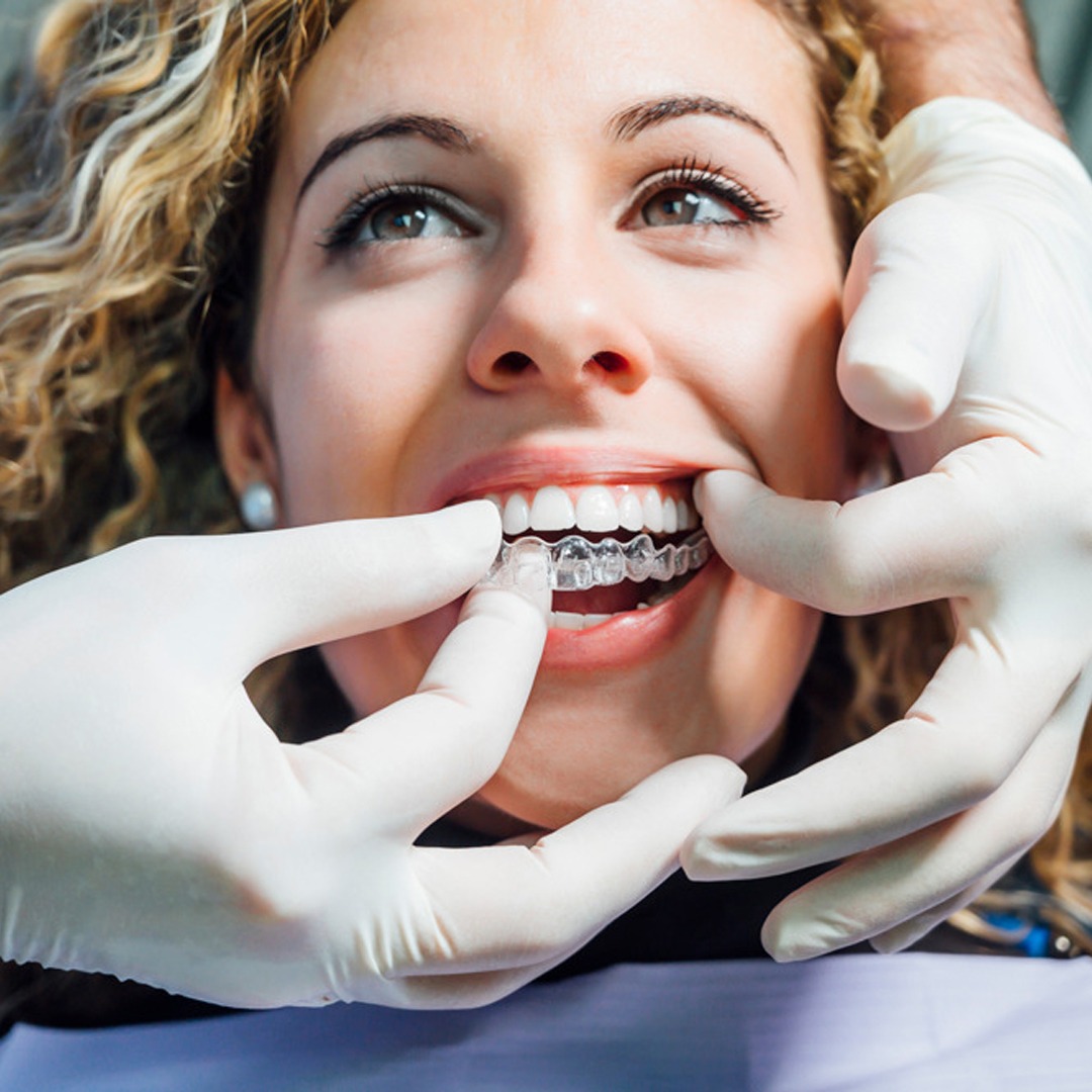 Retainer Treatment Murrieta & Menifee | Braces Retention